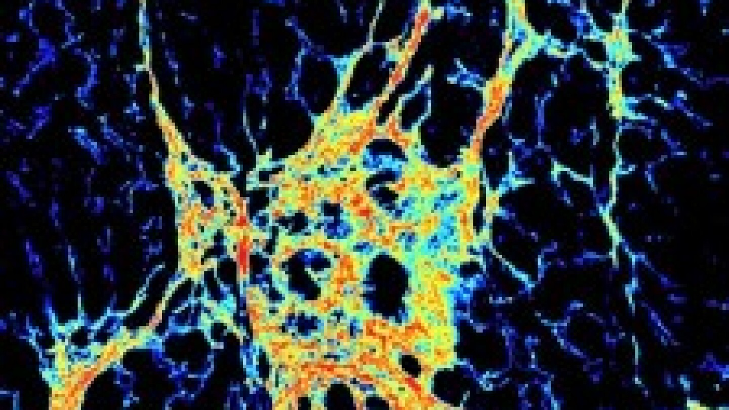 PharmaNest Launches FibroNest, the First Multivendor Image Analysis and ...